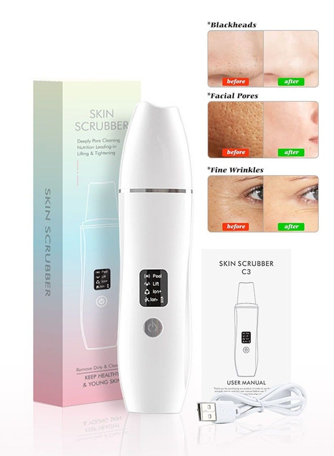 JS Blackhead Remover Skin Scrubber, Deep Vibrate Device, Wrinkles Face ...