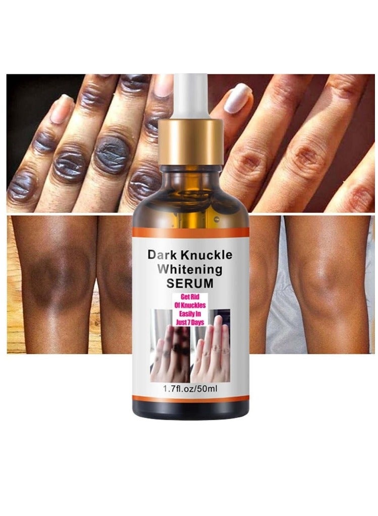 MOOYAM Dark Knuckle Whitening Serum 7 days Treatment for Dark Spots in ...