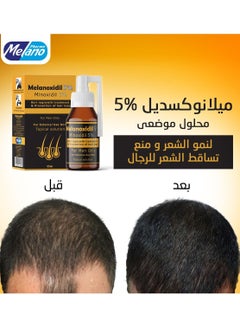 MELANO Melanoxidil 5% topical solution 60 ML UAE | Dubai, Abu Dhabi