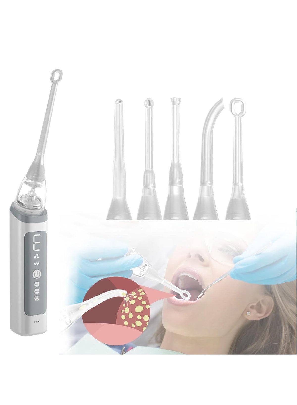 Ru syanl Electronic Vacuum Tonsil Stone Remover Fight Bad Breath Tonsil ...