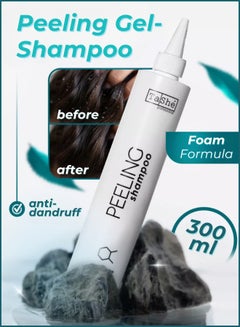 Tashe Deep Scalp Cleansing Peeling Gel Shampoo, Anti Dandruff Hair ...