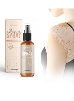 OUHOE Vitiligo Removal Relief Spray，Promote Melanin Recovery,Reduces ...