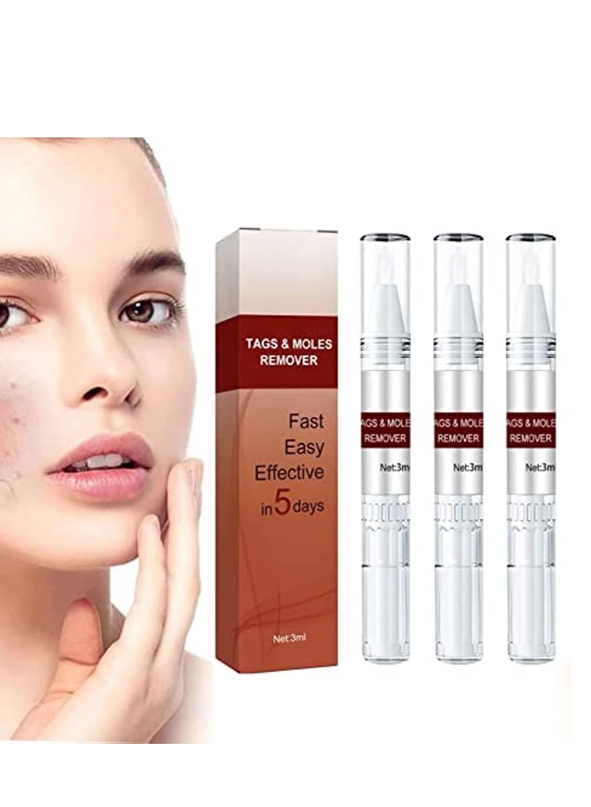 Excefore 3 Pcs Wipe Off Tags and Mole Remover, Skin Tag Remover Mole ...