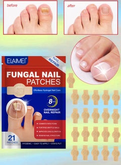 Elaimei 21Pcs Fungal Nail Patch Nail Treatment Renews Nails Structure ...