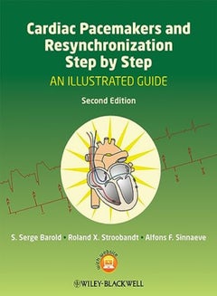 Cardiac Pacemakers and Resynchronization Step by Step | Best Price KSA ...
