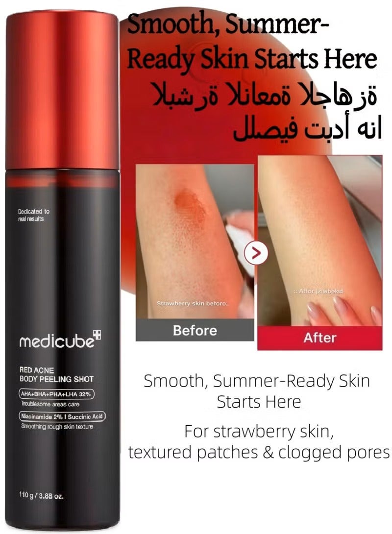 Medicube Red Acne Body Peeling Shot, Red Body Peeling Shot, Effective ...
