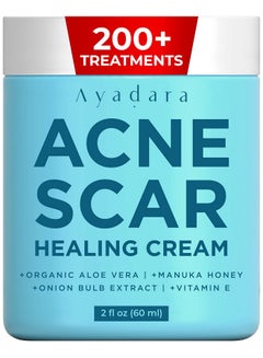 AYADARA Acne Scar Healing Cream With Vitamin E. Face Cream Heals Acne ...