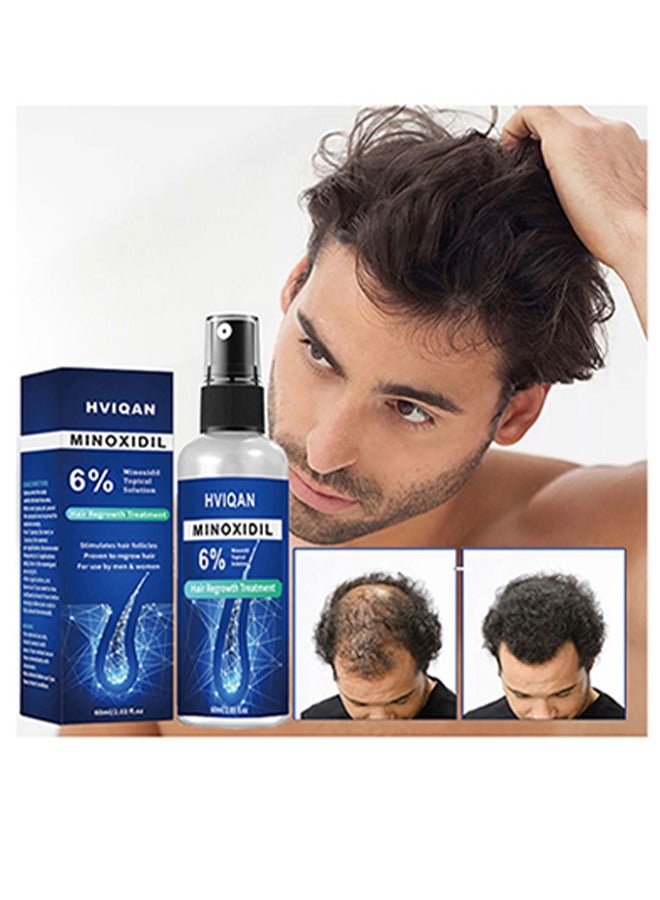 Hviqan 6% Minoxidil Topical Solution Hair Regrowth Treatment， Spray For ...