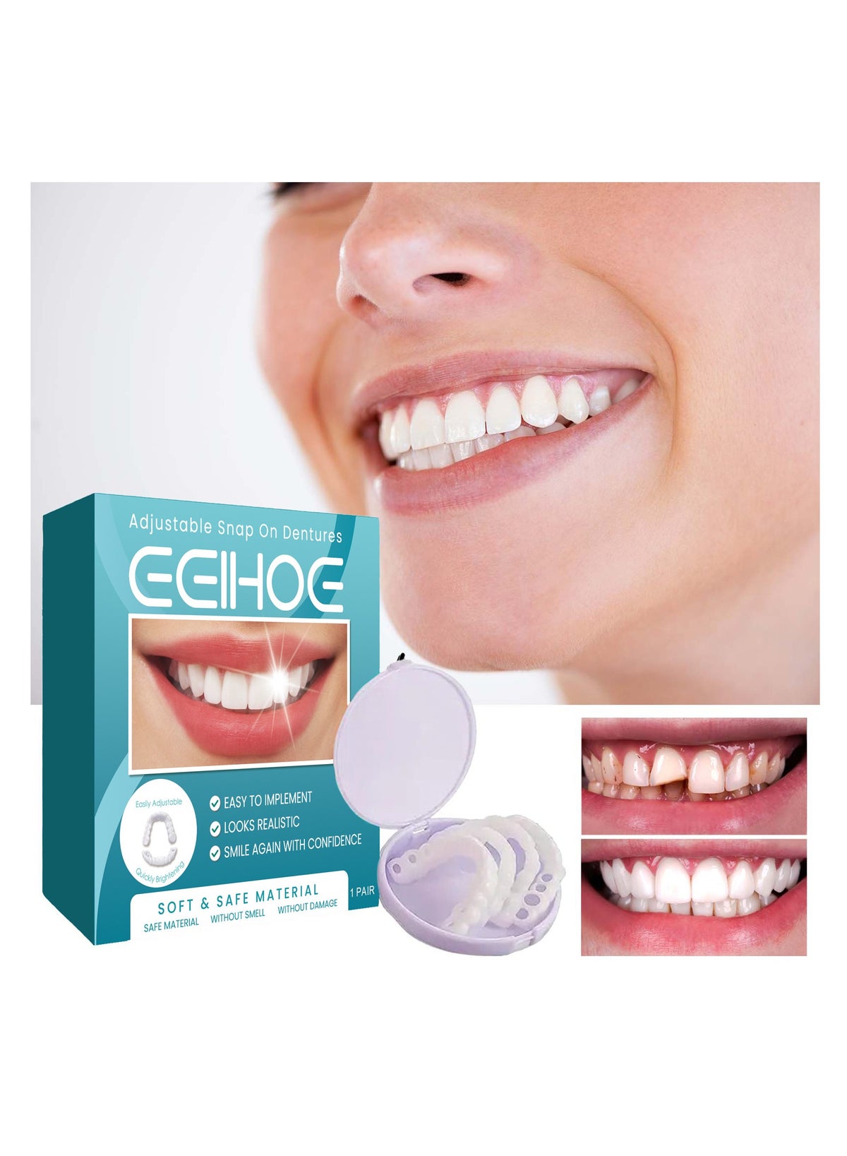 EELHOE EELHOE Adjustable Snap-On Dentures, Upper and Lower Jaw Cosmetic ...