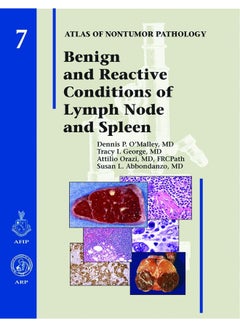 Benign and Reactive Conditions of Lymph Node and S UAE | Dubai, Abu Dhabi