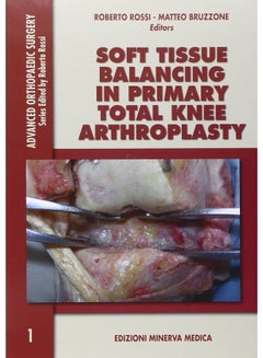 Soft Tissue Balancing in Primary Total Knee Arthroplasty UAE | Dubai ...