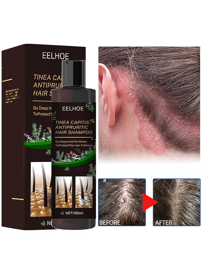 EELHOE Tinea Capitis Antipruritic Hair Shampoo, Anti-Dandruff Shampoo ...