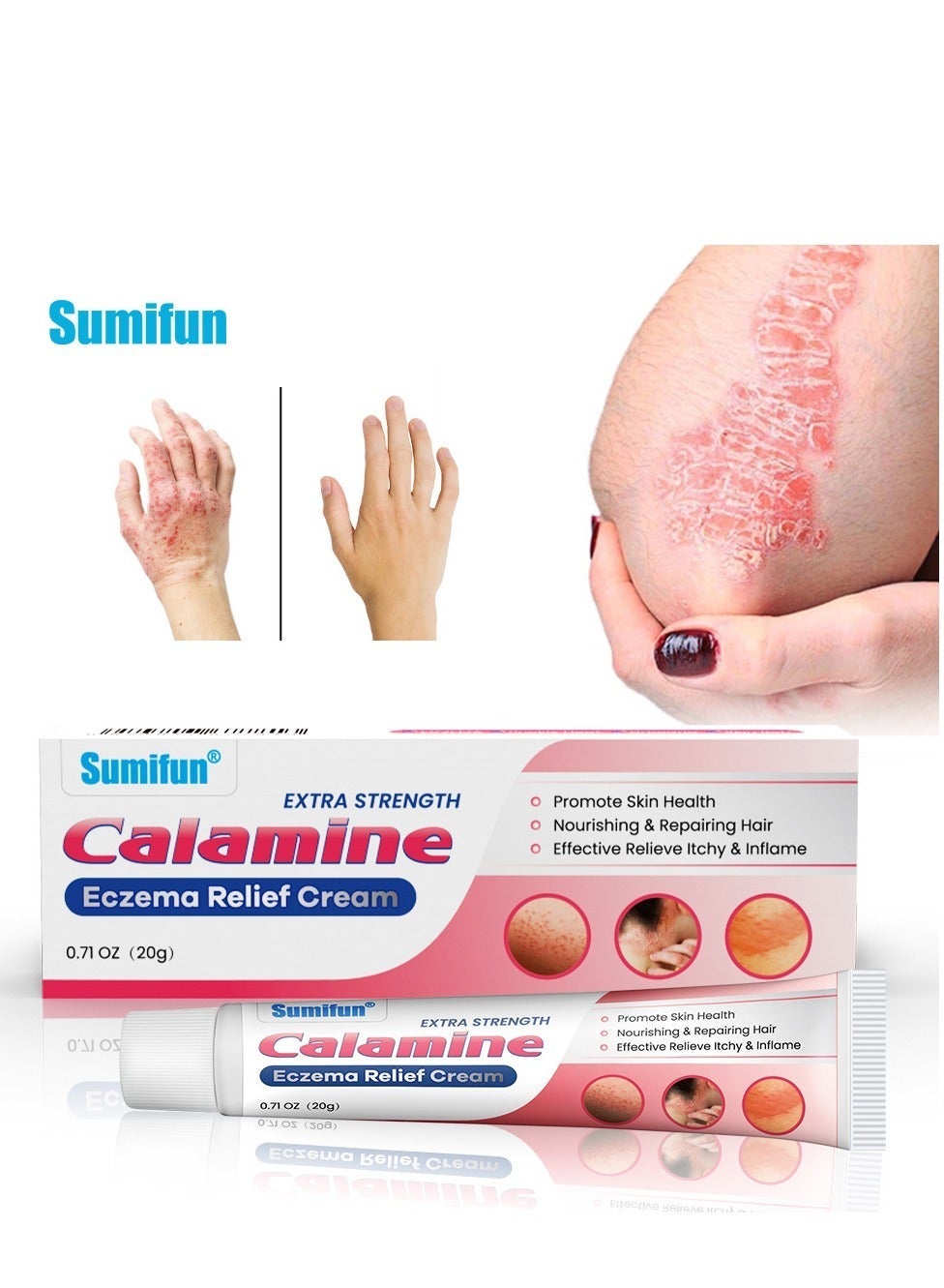 Sumifun Extra Strength Calamine Eczema Relief Cream, Promote Skin Health, Effective Relieve ...