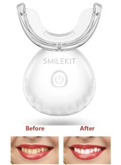 Generic Wireless Teeth Whitening Kit, Suitable For Sensitive Teeth Gums ...
