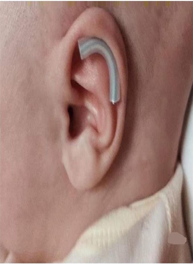 Generic Ear Correction Device for Babies - Built-in Orthotic Shaper ...