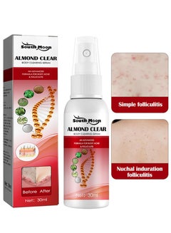 SOUTH MOON Back Acne Treatment Spray, Salicylic Acid Back and Body Acne ...