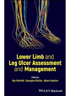 Lower Limb and Leg Ulcer Assessment and Management | Best Price KSA ...