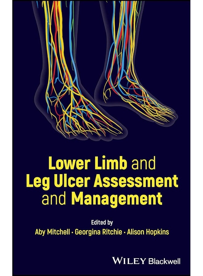 Lower Limb and Leg Ulcer Assessment and Management | Best Price UAE ...